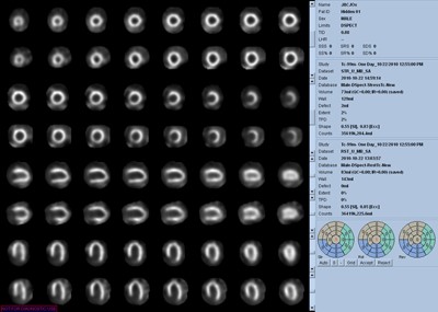 NUCLEAR STRESS TEST - LICC