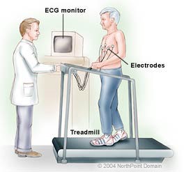 EKG Stress Test - LICC